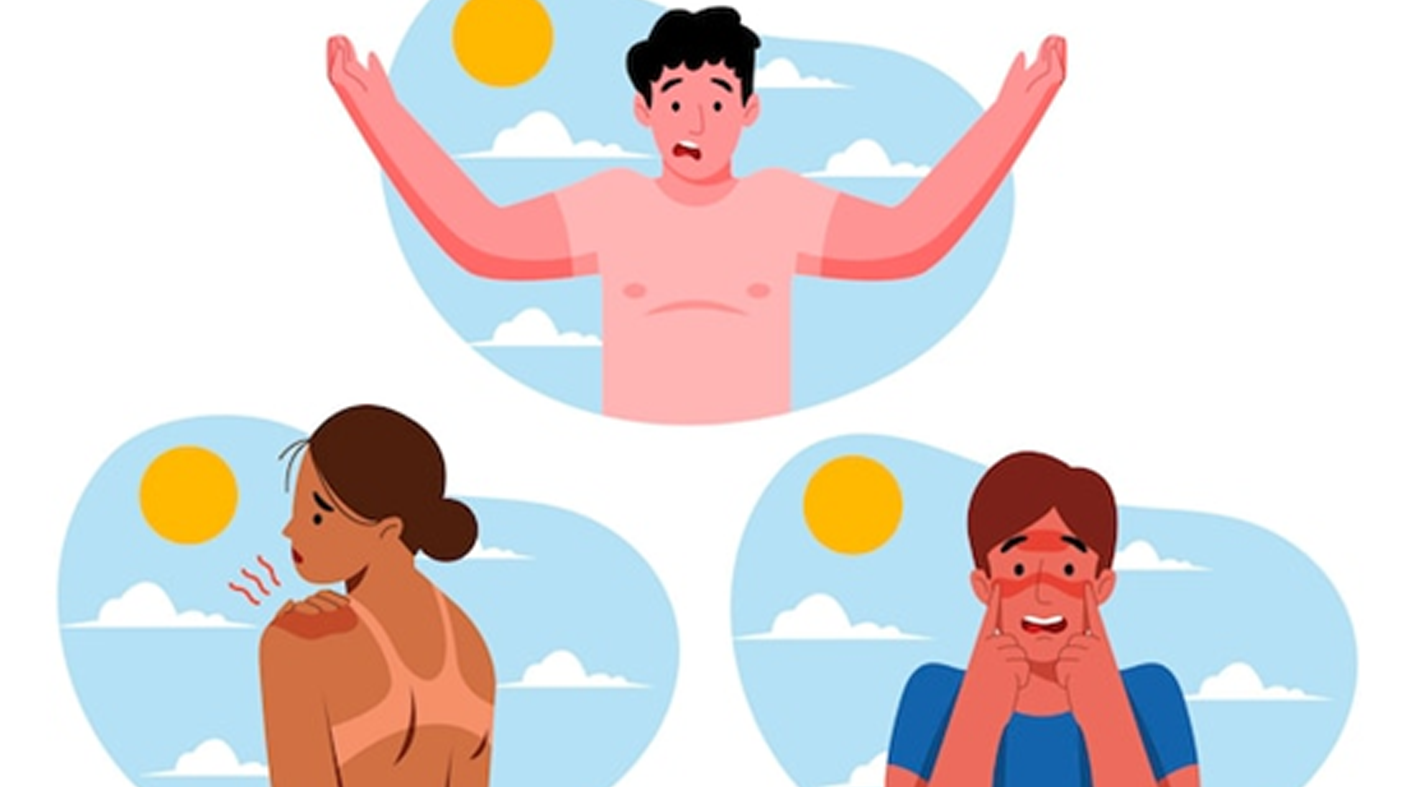 Men Skincare: How to Heal and Prevent Sunburn – Assembled Skincare