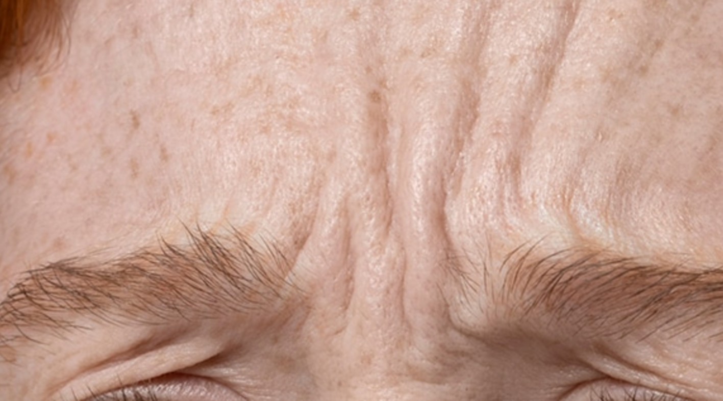 Men's Skincare 101: How Vitamin C Can Help Prevent Wrinkles and Fine L ...