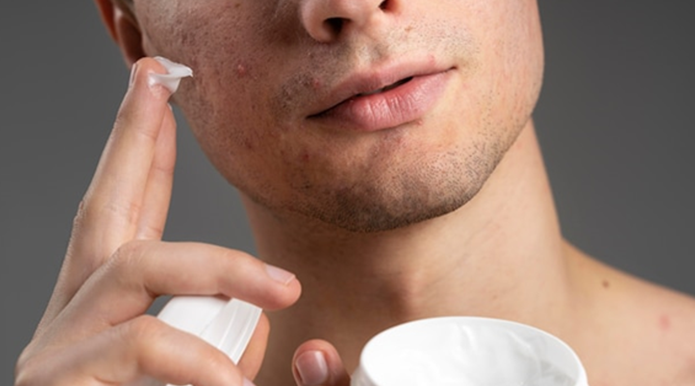 The Gentle Solution for Men's Acne-Prone Skin: Gluconolactone Explaine ...